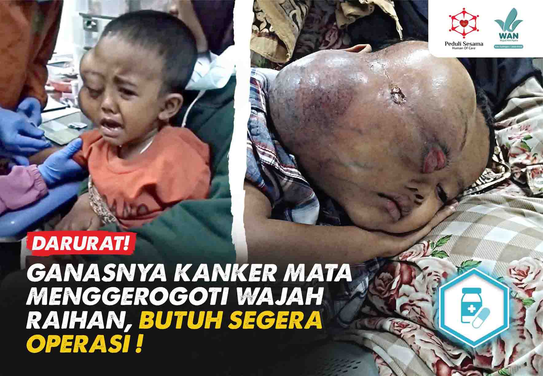 Campaign - Urgent ! Bantu Raiyhan Sembuh Dari Kanker Ganas | Peduli Sesama